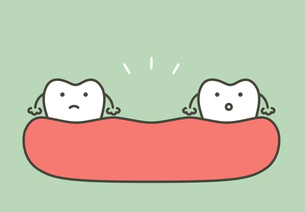 ¿Qué es la anodoncia? » Clinica Dental Urbina en Salamanca